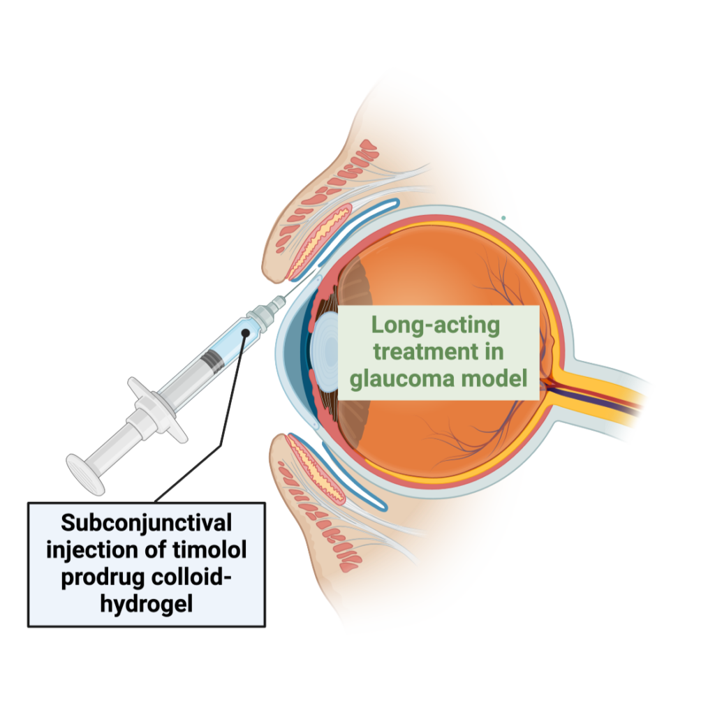 New drug delivery system could improve glaucoma treatment - Institute ...